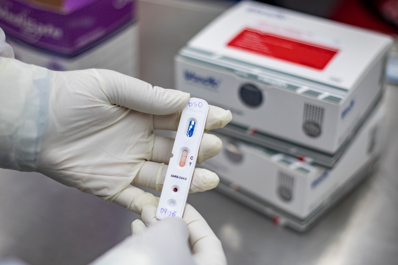 Governo do Ceará distribuirá mais 280 mil testes rápidos na Capital e ...